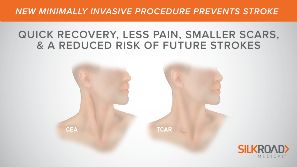 Vascular Surgery | The Surgical Clinic in Nashville, TN