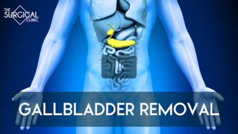 What Are the Symptoms of a Gallbladder Attack | The Surgical Clinic