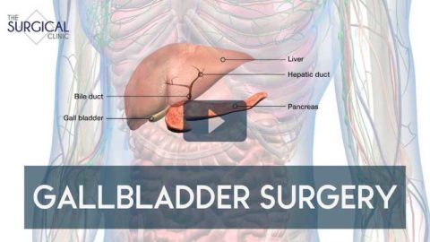 What Are the Symptoms of a Gallbladder Attack | The Surgical Clinic