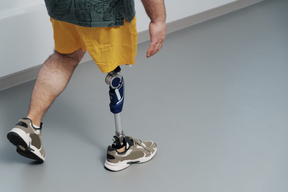 How Advanced Prosthetics Can Improve Quality of Life | TSC